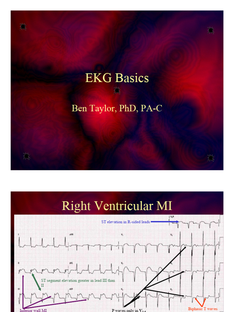 EKG Basics: Understanding Heart Rhythms | PDF | Electrocardiography ...