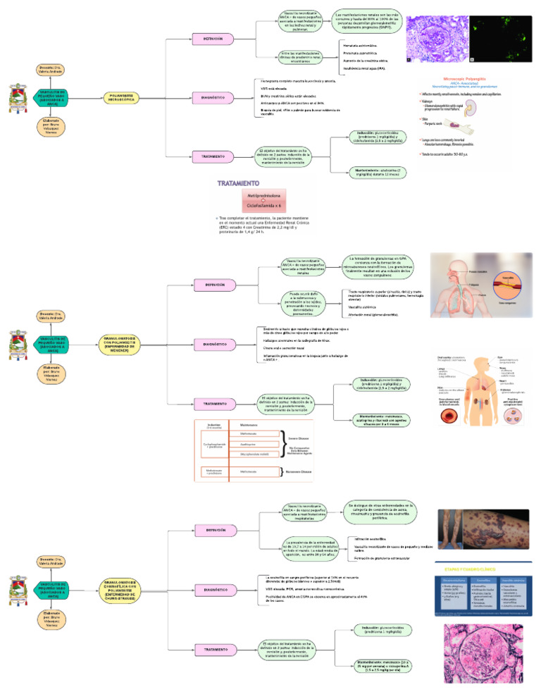 Vasculitis Anca | PDF | Inmunología | Medicina