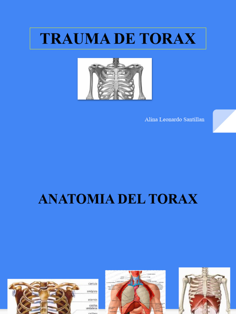 Trauma de Torax - Expo | Descargar gratis PDF | Medicina CLINICA | Enfermedades y trastornos