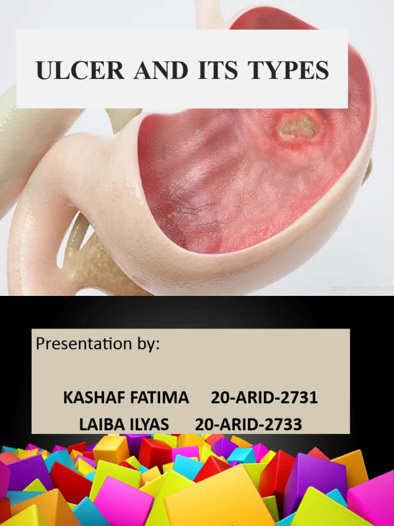 Ulcer ppt-1 | PDF | Medical Specialties | Clinical Medicine