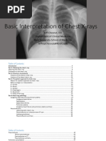 The Radiology Assistant - Chest X-Ray - Basic Interpretation | PDF | Heart Valve | Atrium (Heart)