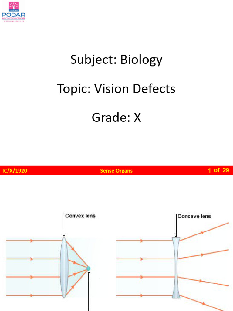 X_Bio_vision defects | PDF | Myopia | Eye