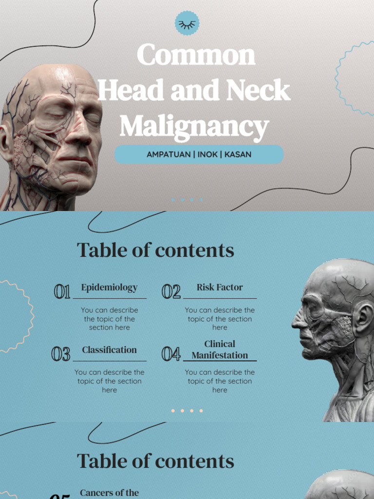 Head and Neck Malignancy | PDF | Head And Neck Cancer | Skin Cancer
