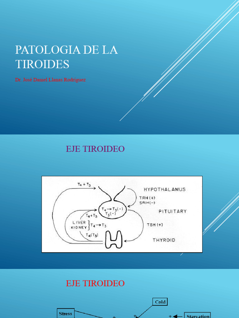 PATOLOGIA DE LA TIROIDES | PDF | Hipertiroidismo | Tiroides