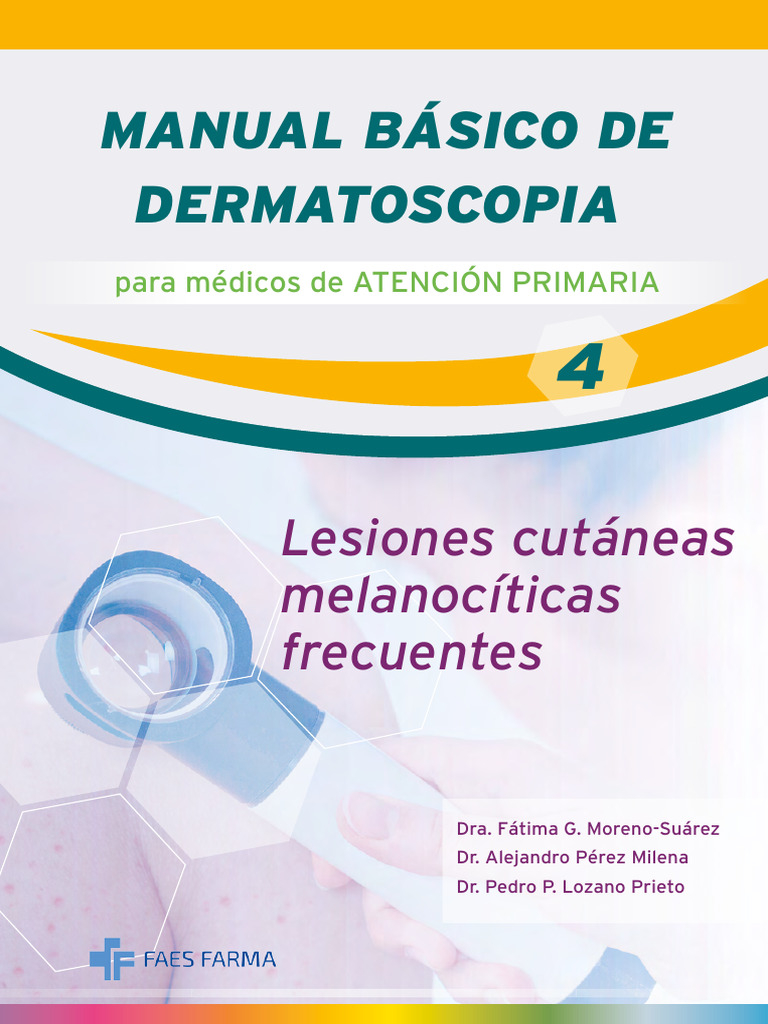 Manual Dermatoscopia AP #4 Melanociticas n4 26 5 21 | PDF | Melanoma ...