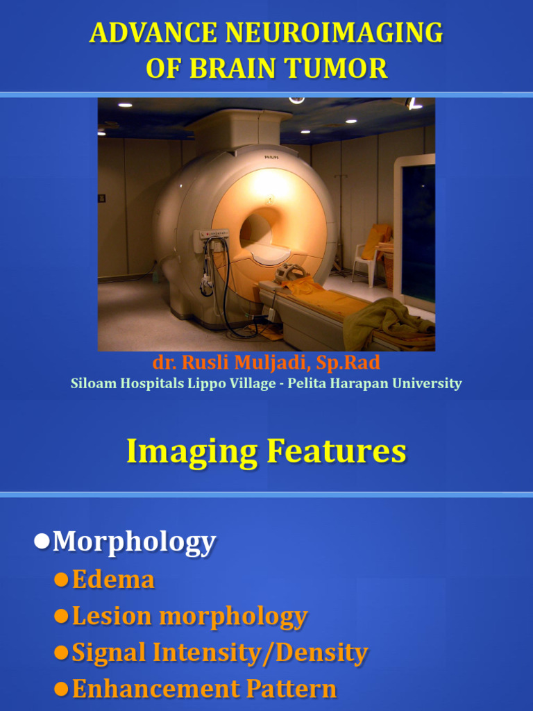 Mri Brain Tumor DW, Dti, Mrs | PDF | Magnetic Resonance Imaging | Brain ...