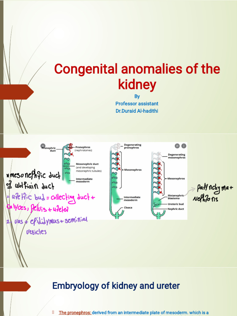 Congenital anomalies of the kidney | PDF | Kidney | Organ (Anatomy)