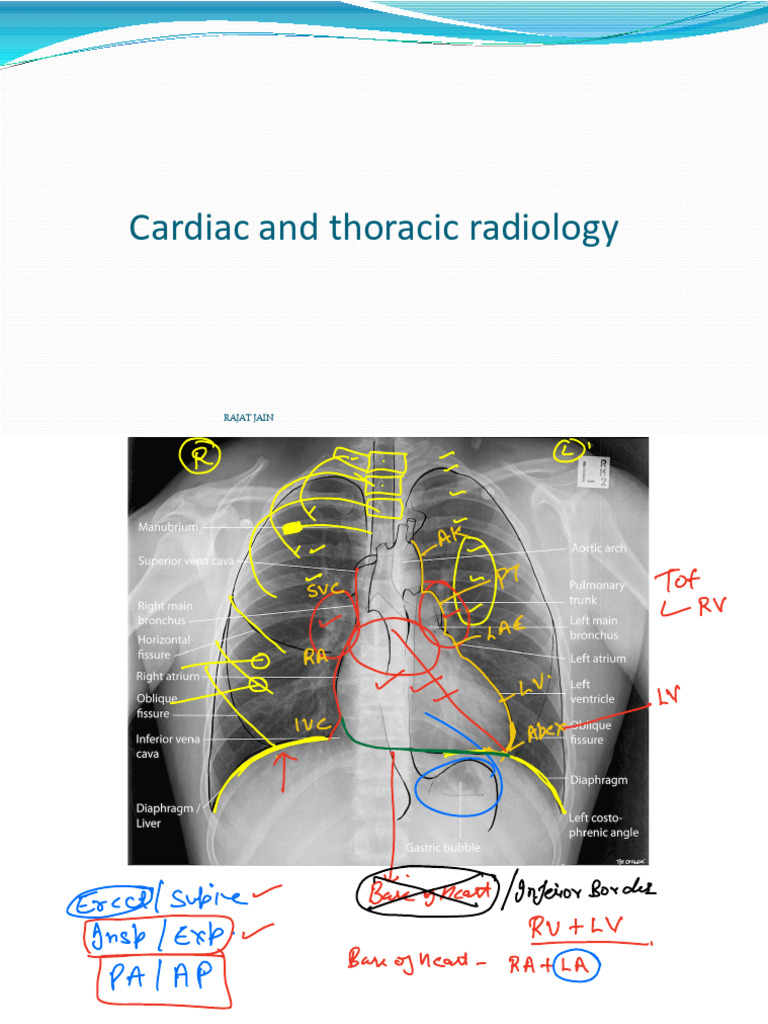 Radiology Day 3 Part 1 | PDF | Angiology | Cardiovascular System
