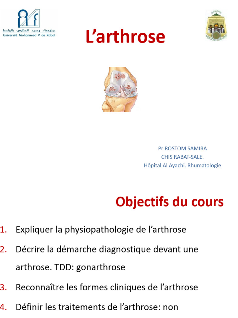 Physiopathologie de l'arthrose expliquée | PDF | Cartilage | Arthrose