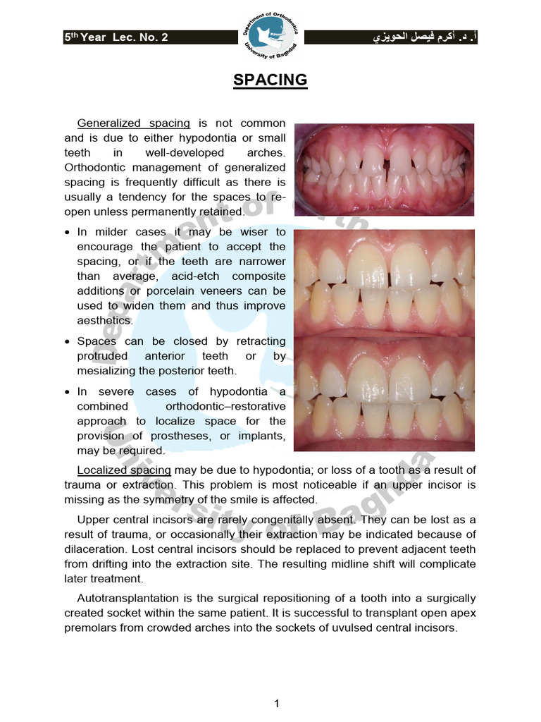 Orthodontic Lect 12 | PDF | Dental Implant | Dental Anatomy