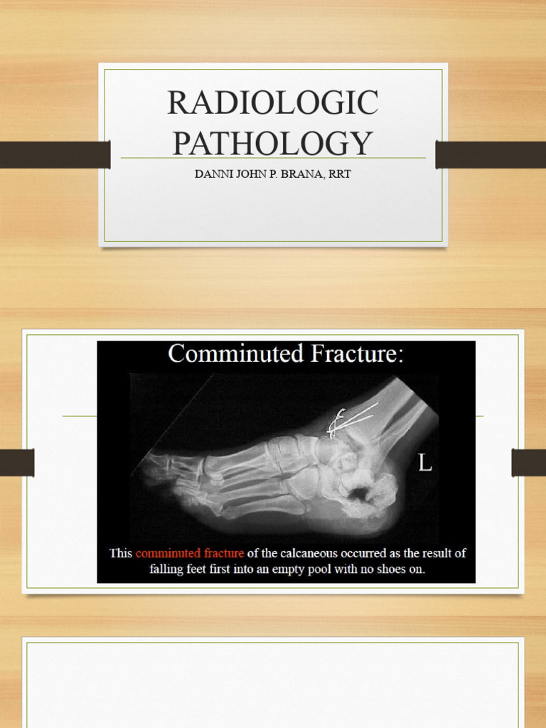 Radiologic Pathology 5 Nervous | PDF | Stroke | Cerebrospinal Fluid
