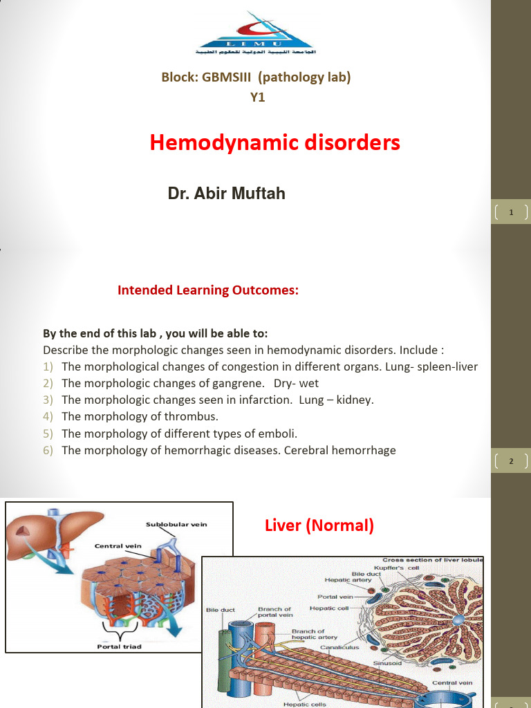 Hemodynamic Disorders Lab 3 | PDF | Thrombus | Embolism