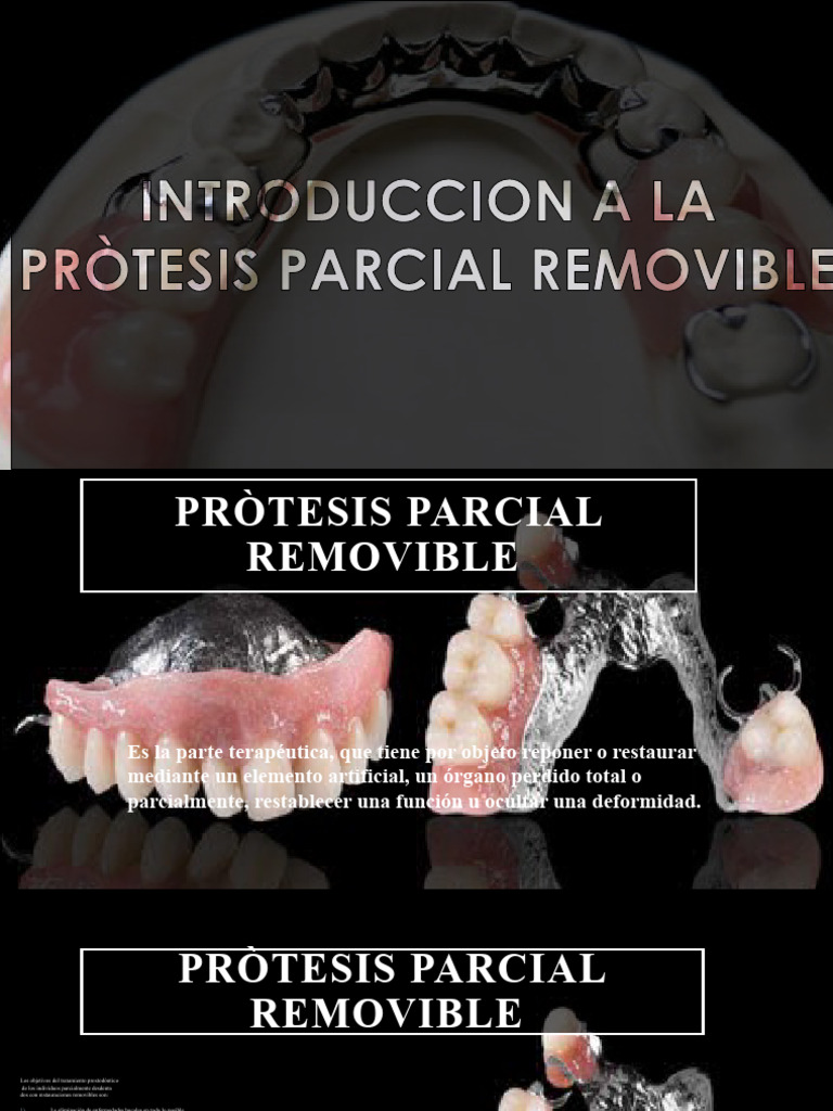 Tipos de PPR Conceptos Basicos | PDF | Boca | Odontología