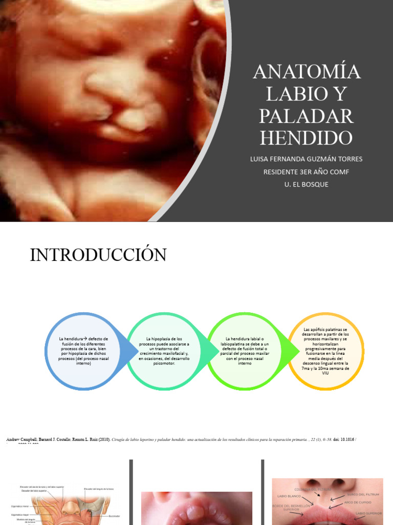 Anatomia Labio y Paladar Hendido | PDF | Anatomía | Cara