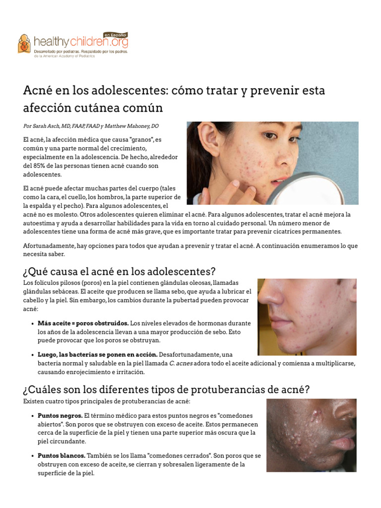Tratamiento y Prevención del Acné Adolescente | PDF | Especialidades ...