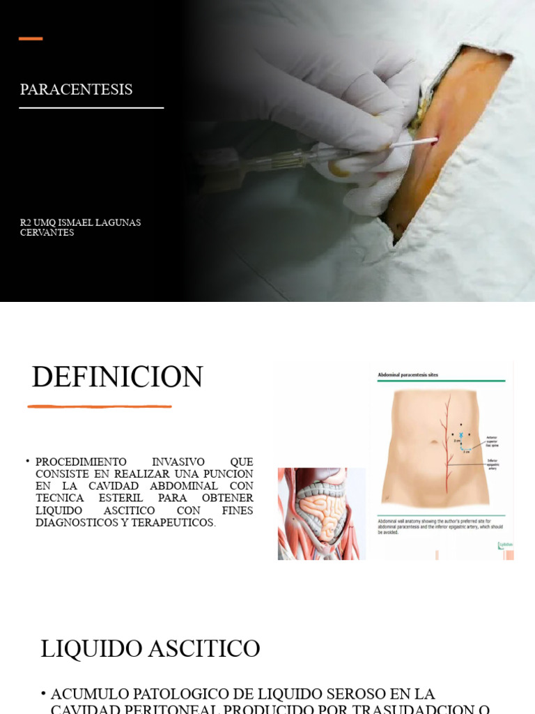 Paracentesis | PDF | Enfermedades y trastornos | Especialidades Medicas