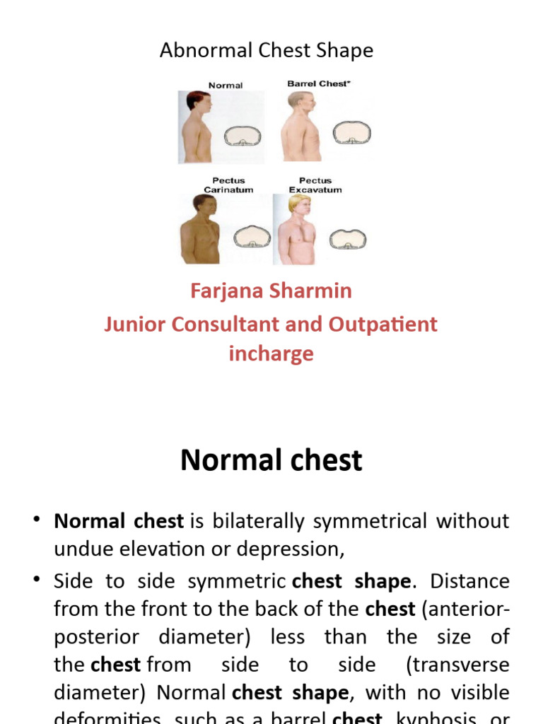 Abnormal Chest Shape | PDF