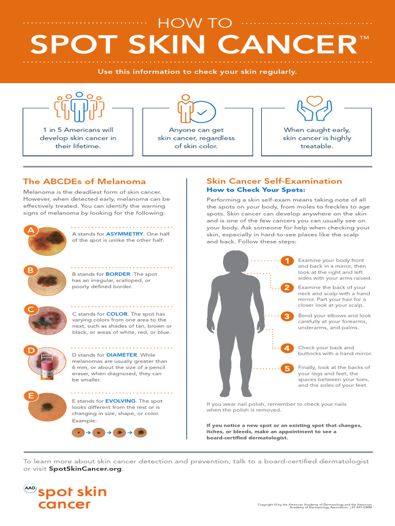 How To Spot Skin Cancer Infographic | PDF | Skin Cancer | Melanoma
