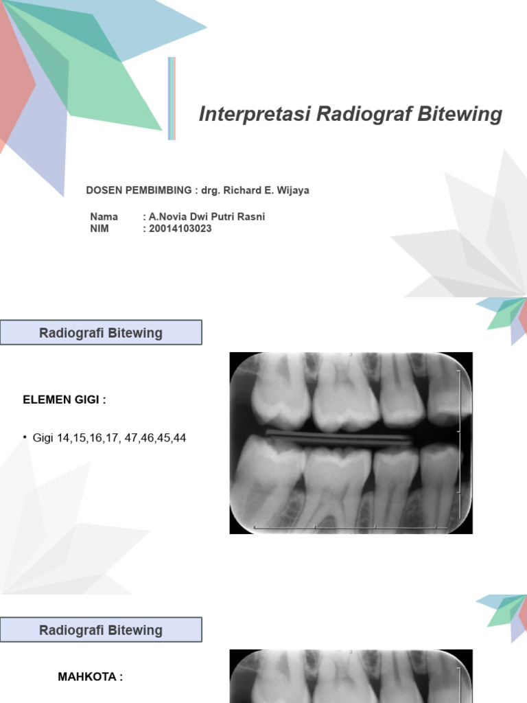 Interpretasi Bitewing | PDF