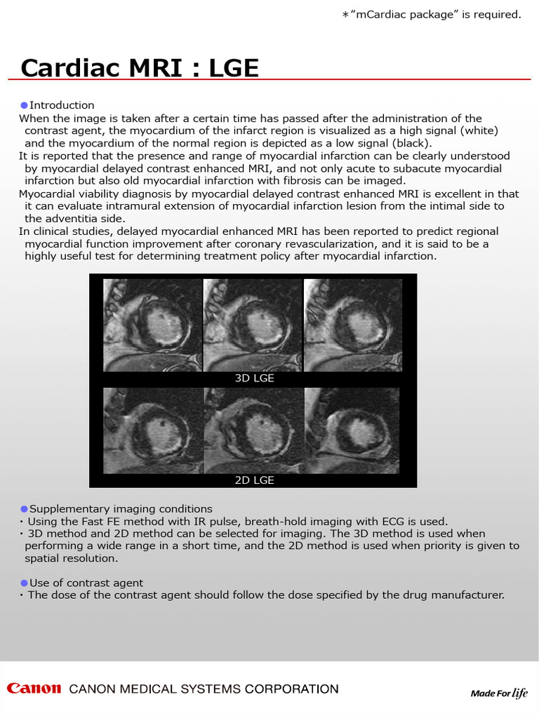 Cardiac MRI LGE Imaging Guide | PDF | Myocardial Infarction | Magnetic ...
