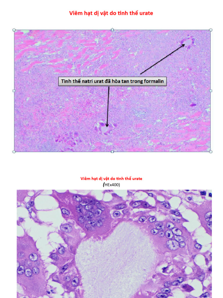 2.VH Di Vat TB 10 | PDF