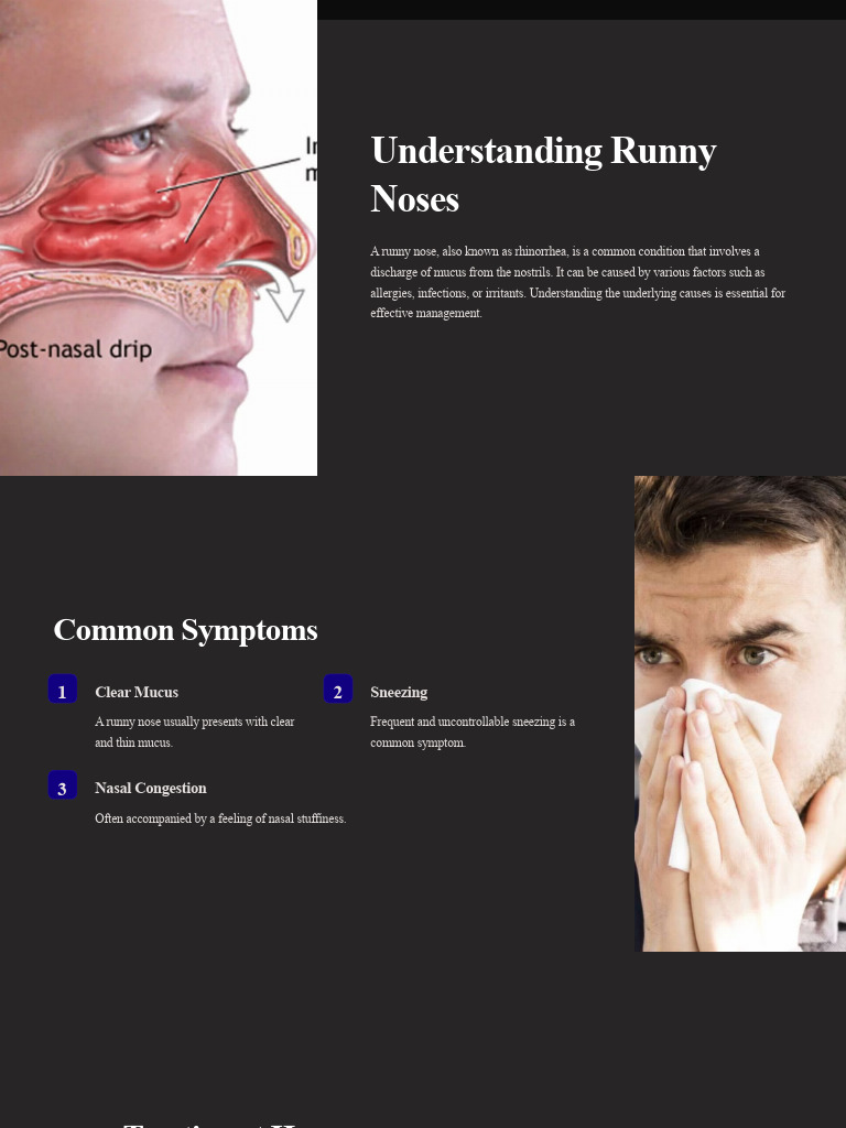 Understanding Runny Noses | PDF | Diseases And Disorders | Rhinology