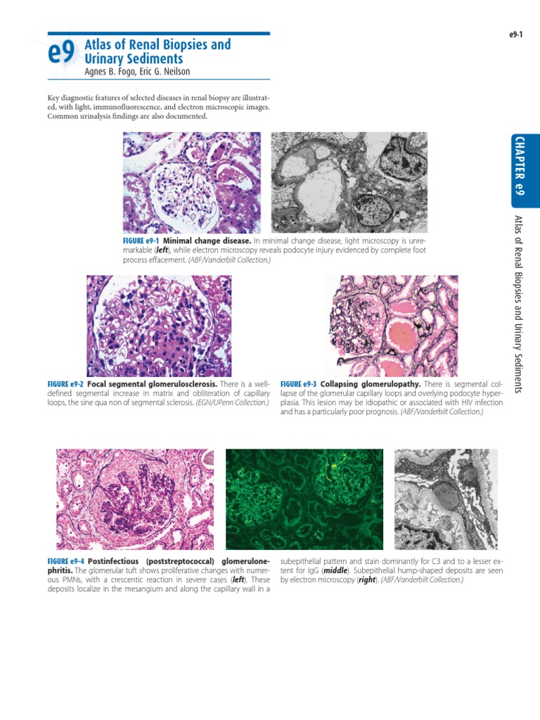 Atlas Urinary Sediments Renal Biopsies | PDF | Urological Conditions | Medicine
