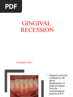 Classification of Dental Surface Defects in Areas of Gingival Recession ...
