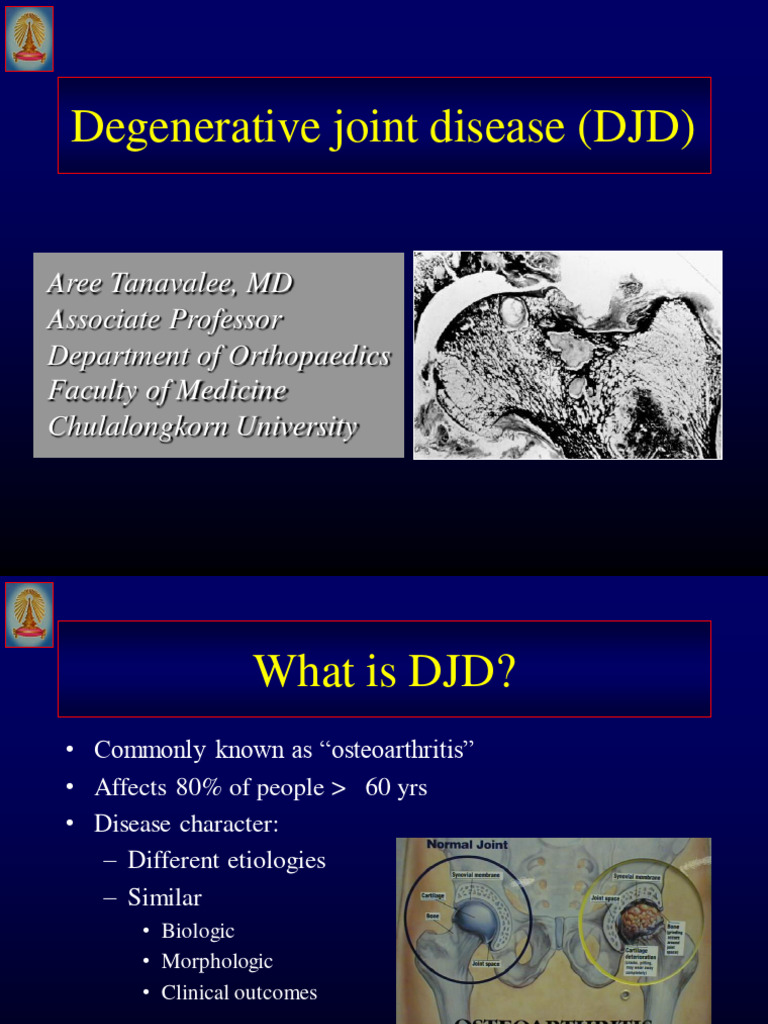 Understanding Osteodegenerative Disease | PDF | Osteoarthritis | Cartilage