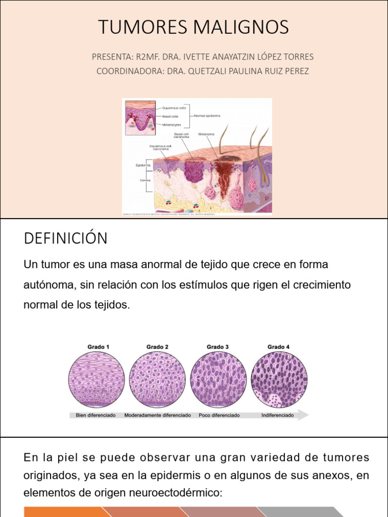 Tumores Malignos | PDF | Cáncer | Neoplasias