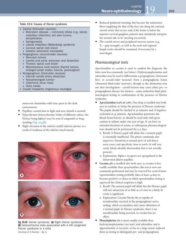 Pupil Pharmacological Tests | PDF | Common Carotid Artery | Nervous System