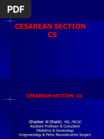LSCS: Definition, Types, and Indications | PDF | Caesarean Section ...