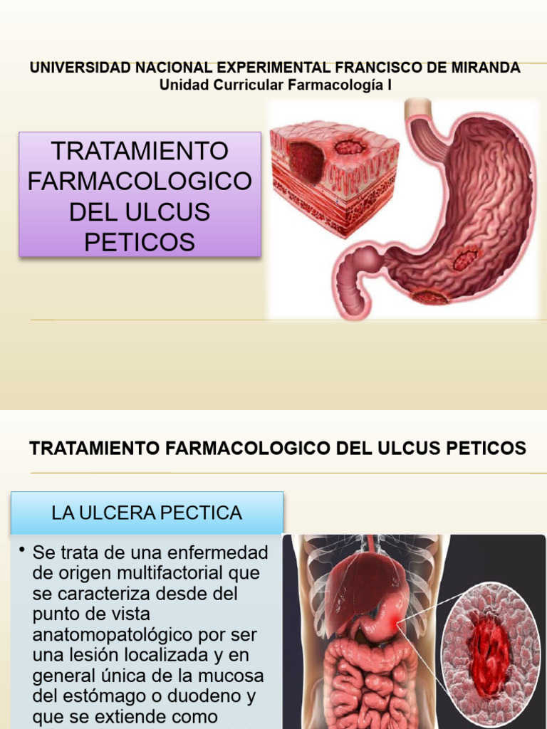 Tratamiento Farmacologico Del Ulcus Peticos - 072534 | PDF | Drogas ...