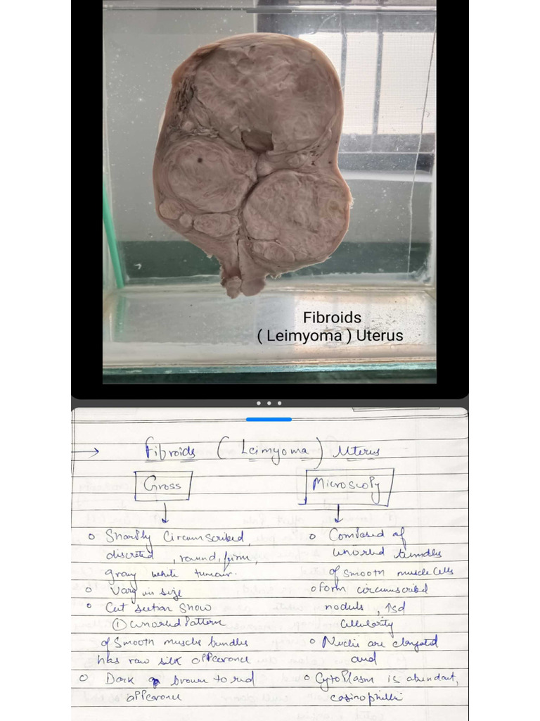 Patho Practical - 231205 - 172539 | PDF