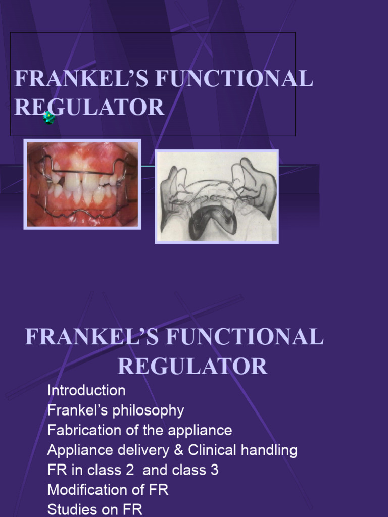 Frankel's Functional Regulator | PDF | Dental Anatomy | Dentistry