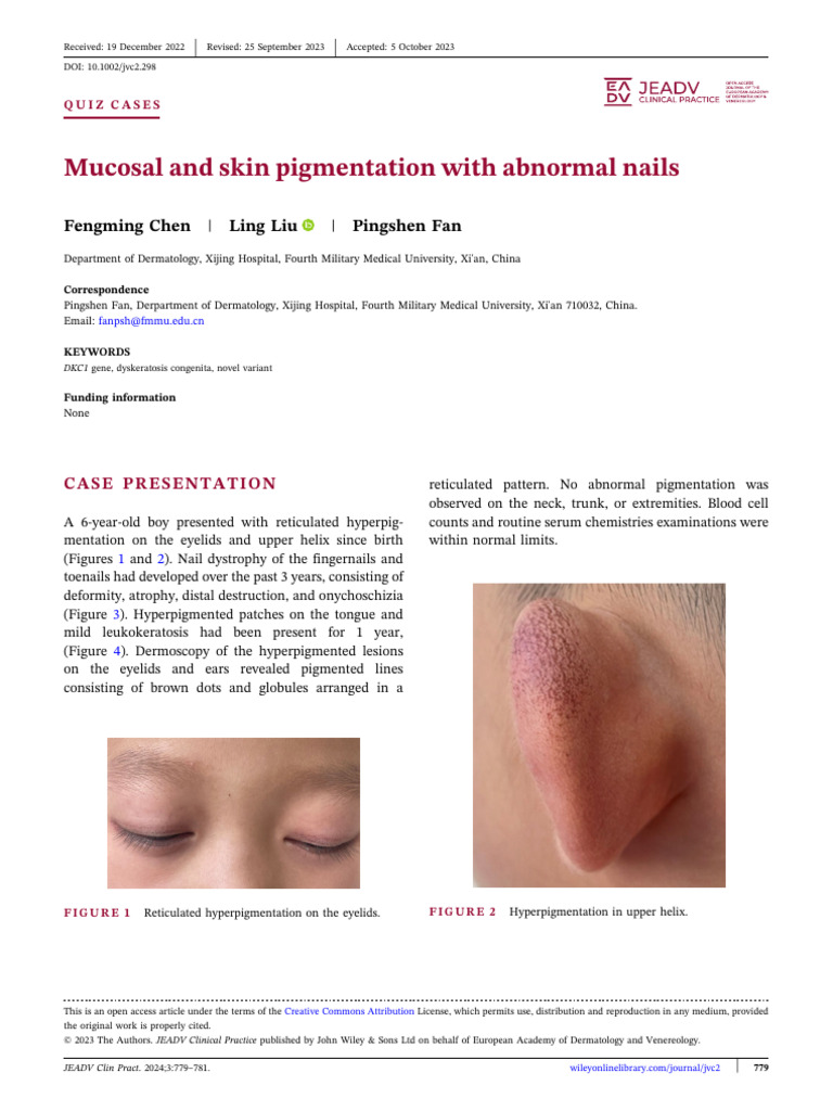 Mucosal and Skin Pigmentation With Abnormal Nails | PDF | Biology ...