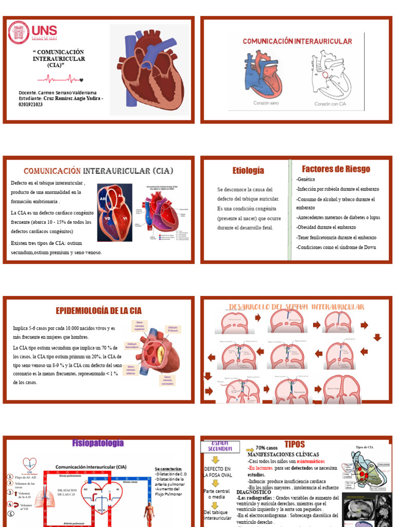 N-Up-Pdf - 1 Comunicación Interauricular. Carmen | PDF | Corazón | El ...