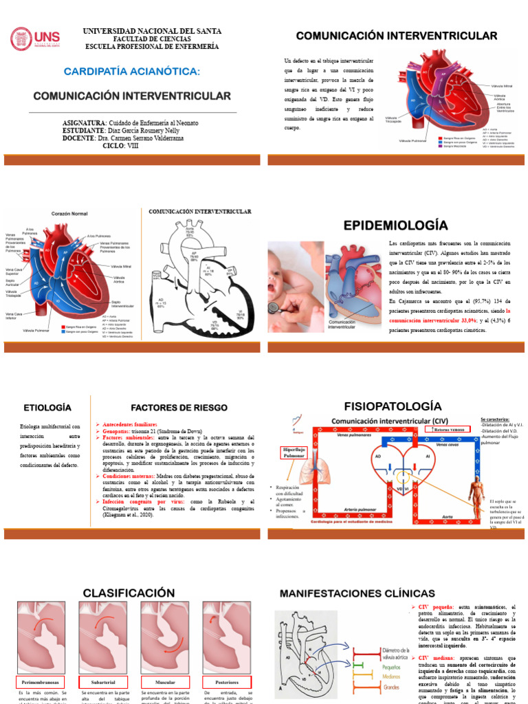 N-Up-Pdf - 3 Comunicación Interventricular Carmen | PDF | Insuficiencia ...