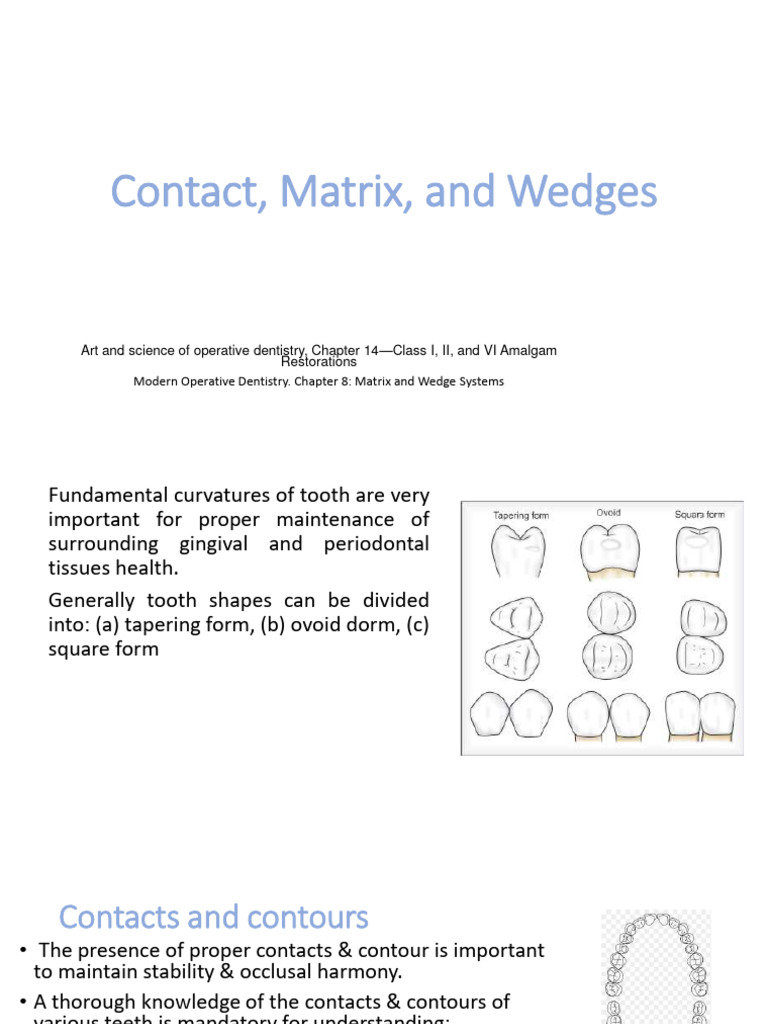 Contact Matrix and Wedges | PDF | Periodontology | Dental Anatomy