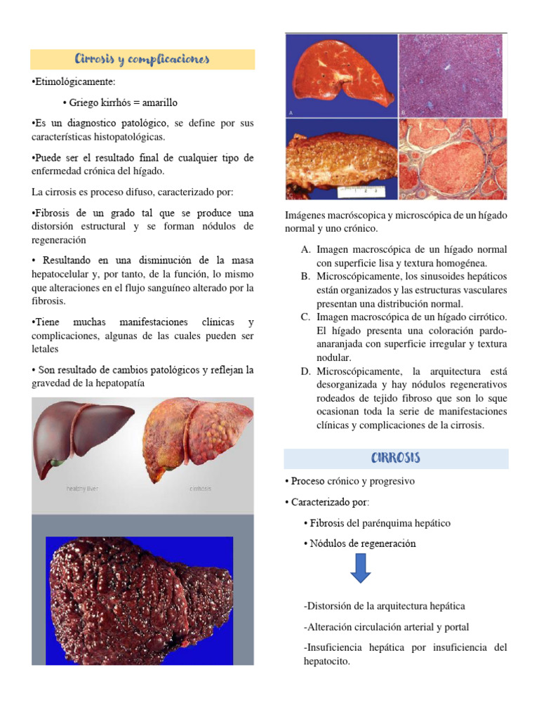 Cirrosis y complicaciones | Descargar gratis PDF | Cirrosis | Hígado