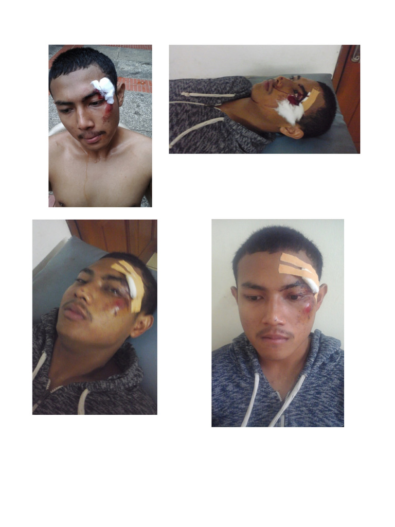 Doc1 Foto Luka | PDF