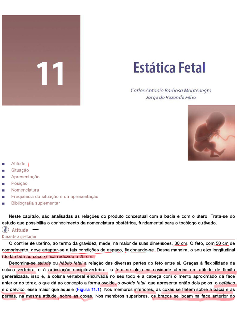 Rezende - Obstetricia 13a Edic - CAPÍTULO 11 - Estática Fetal | PDF