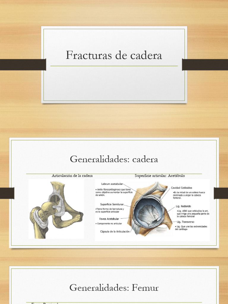 Fracturas de Cadera David | PDF | Rodilla | Sistema musculoesquelético