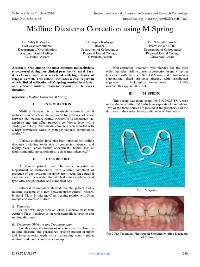 Midline Diastema Correction using M Spring | Download Free PDF ...