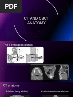 CBCT Anatomy | PDF