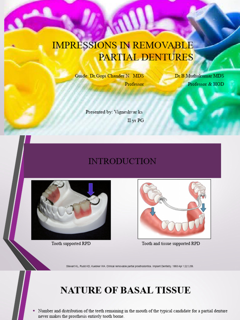 IMPRESSIONS IN REMOVABLE PARTIAL DENTURES ppt | PDF | Dentures | Dental ...
