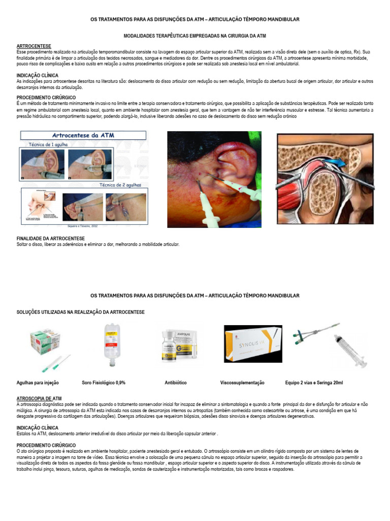 Os Tratamentos para As Disfunções Da Atm - Articulação Têmporo ...