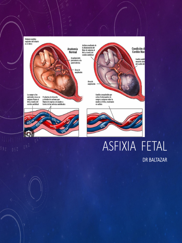Asfixia Fetal: Monitoreo y Consecuencias | PDF | Feto | Corazón