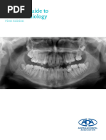 Panoramic Radiograph Interpretation Guide | PDF | Human Nose | Tongue
