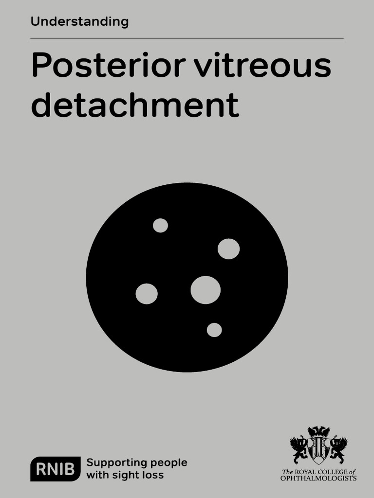 Understanding Posterior Vitreous Detachment | PDF | Human Eye ...